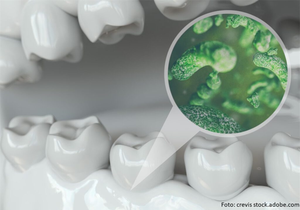 Zahnbelag - Entstehung und Maßnahmen | medentes